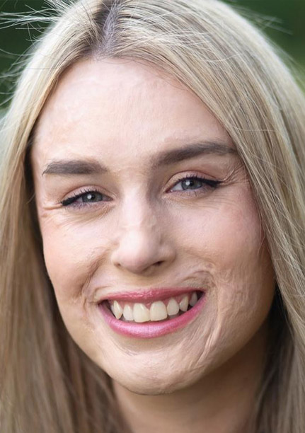 La Roche Posay – A Better Life for Sensitive Skin